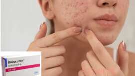 ROACUTAN PARA TRATAMENTO DE ACNE - Dra. Alessandra Drummond